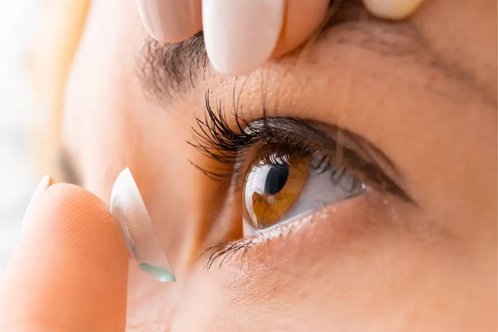 Do Contact Lenses Expire? | The Bromley Eye Centre